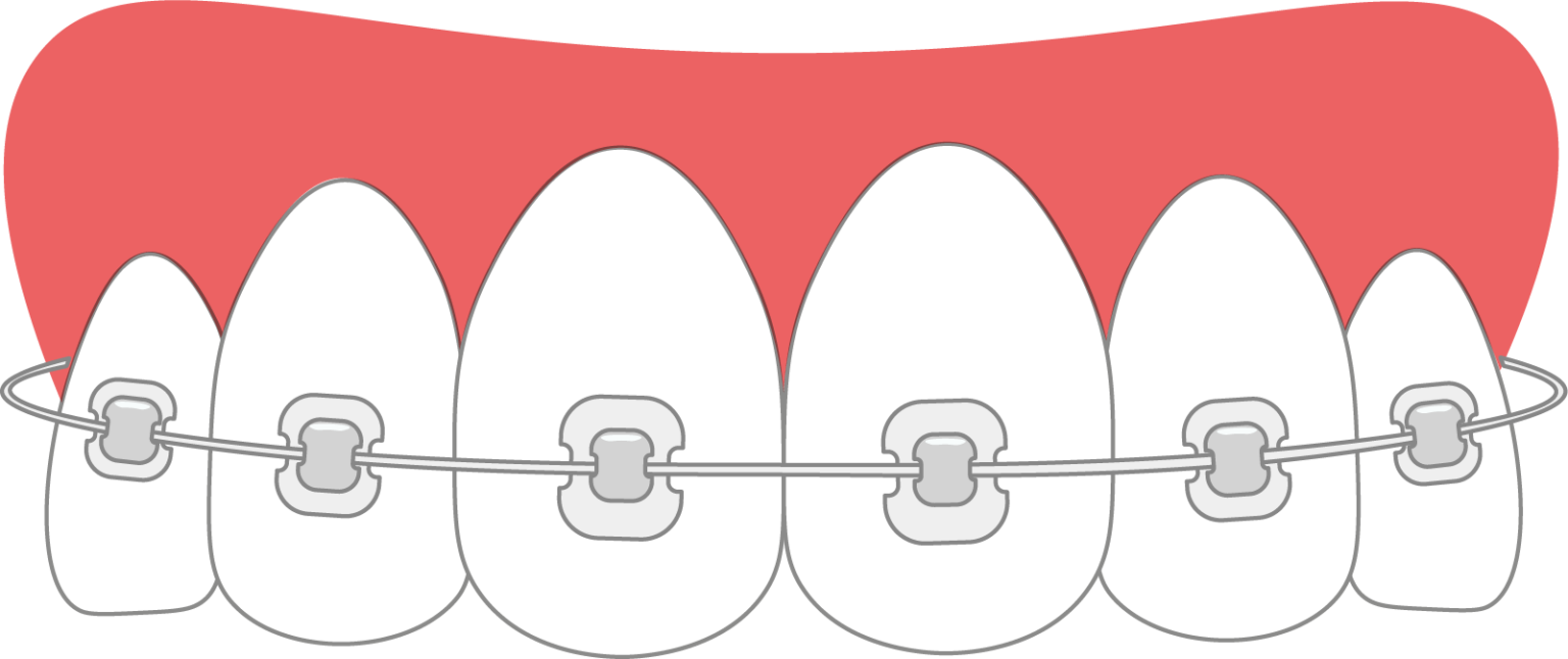 Ortodontinis gydymas - A. Mackevičiaus odontologijos klinika - Vilnius